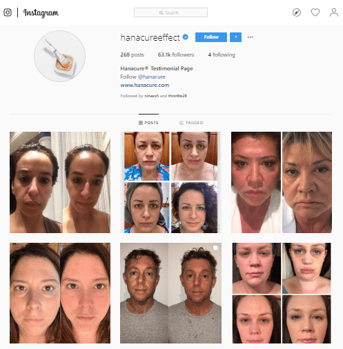 Hanacure Select Instagram Images - Nativa
